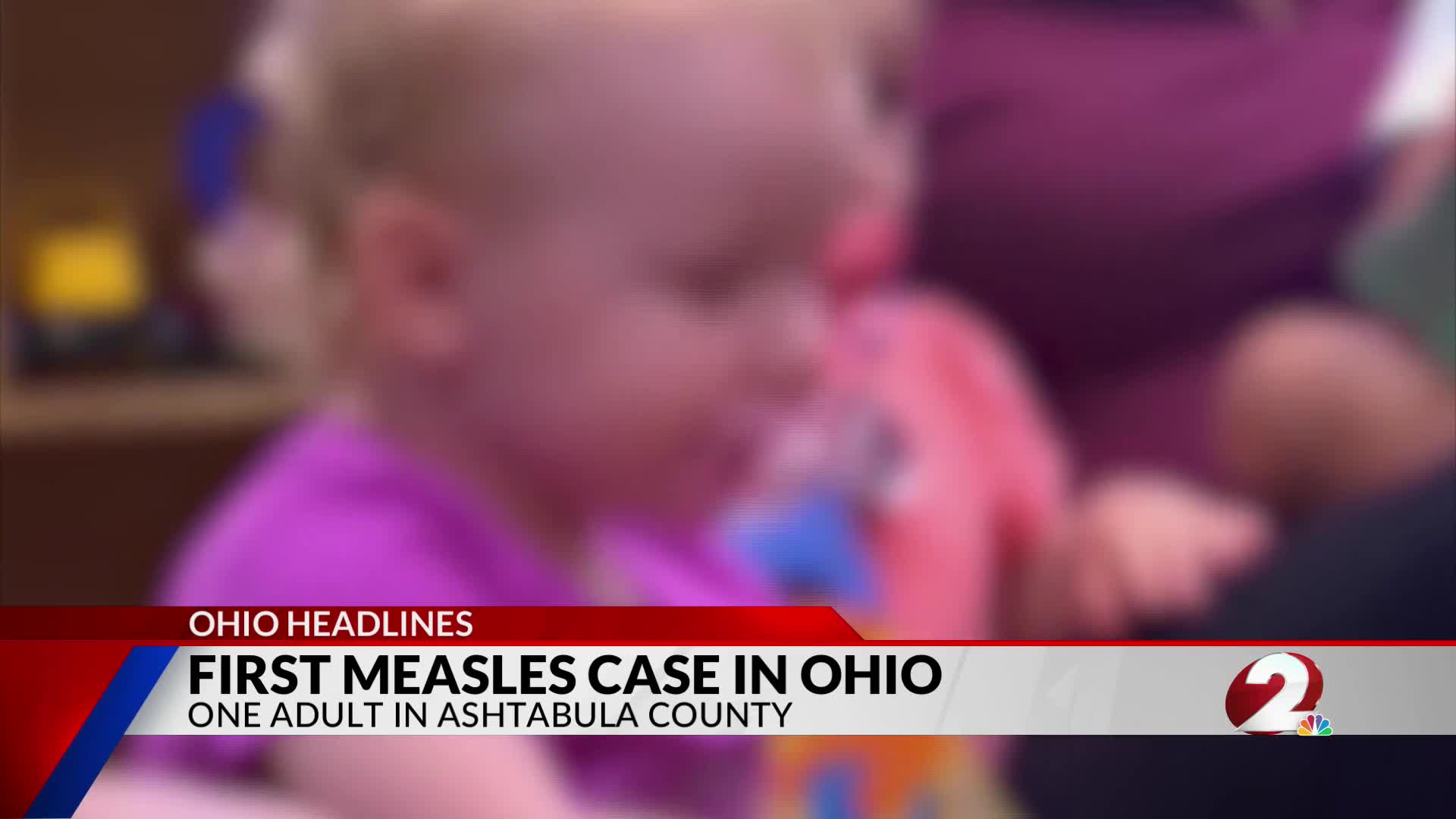 Ohio’s 1st measles case of 2025 discovered – WDTN.com